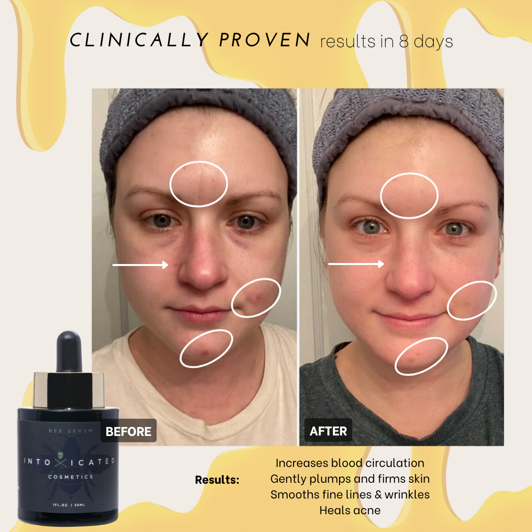 Bee Serum – Intoxicated Cosmetics