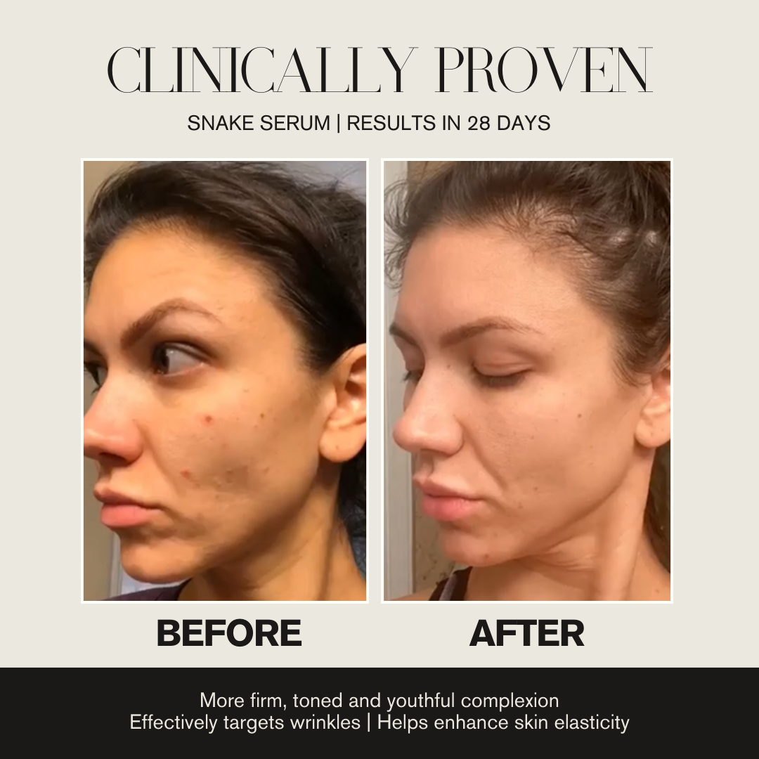 Snake Serum + Antidote Moisturizer | Intoxicated Cosmetics